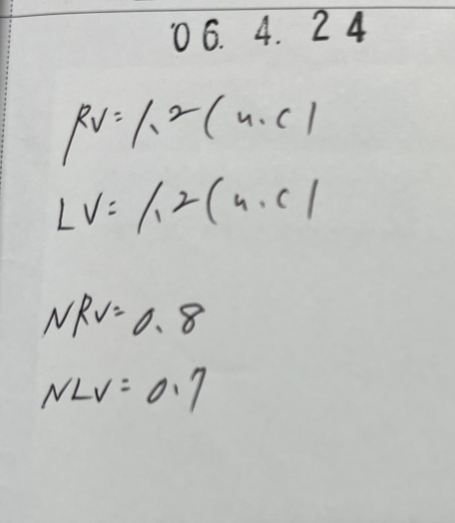 +8ディオプターの遠視、-9ディオプターの乱視の治療 〜ICL、IPCL〜 | 柳津あおやま眼科クリニック